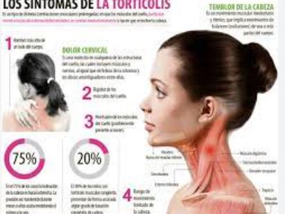 Torticolis: causas y que hacer en caso de tener unaMis Bellos Momentos